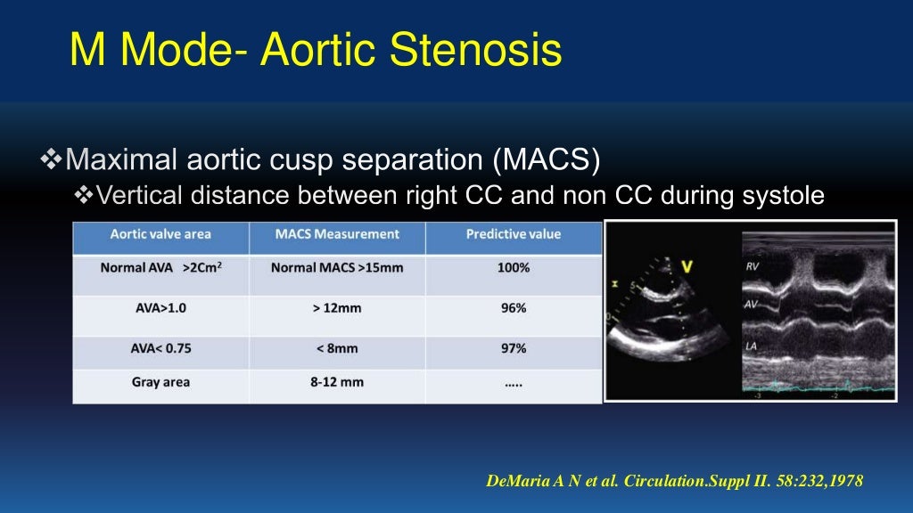 Echo assesment of Aortic Stenosis and Regurgitation