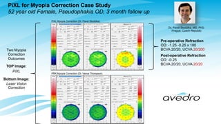 Avedro | PDF