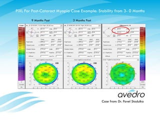 Avedro | PDF | Eye and Vision Conditions | Diseases and Conditions