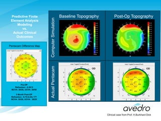 Avedro | PDF