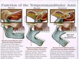 A VEIW ON TEMPOROMANDIBULAR JOINT | PPTX