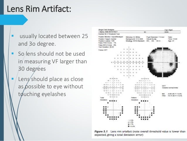 AVF by suraj chhetri