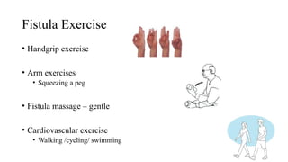 Arteriovenous fistula creation for hemodialysis | PPTX