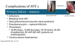 Arteriovenous fistula creation for hemodialysis | PPT