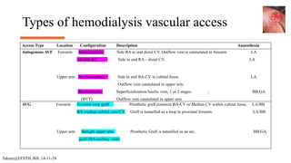Arteriovenous fistula creation for hemodialysis | PPTX