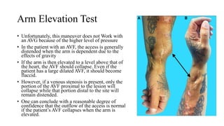 Arterio-Venous Access examination | PPTX