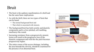 Arterio-Venous Access examination | PPTX