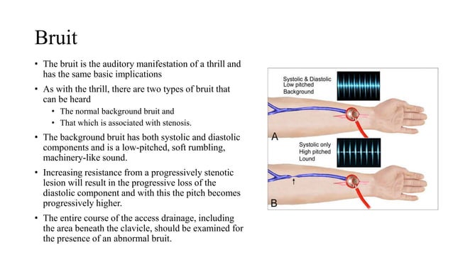Arterio-Venous Access examination | PPTX