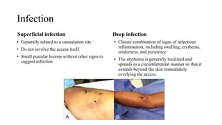 Arterio-Venous Access examination | PPTX
