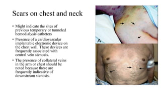 Arterio-Venous Access examination | PPTX