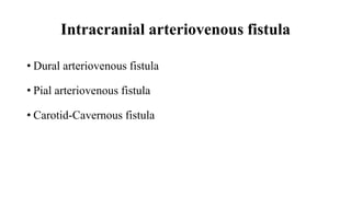 AV fistula.pptx