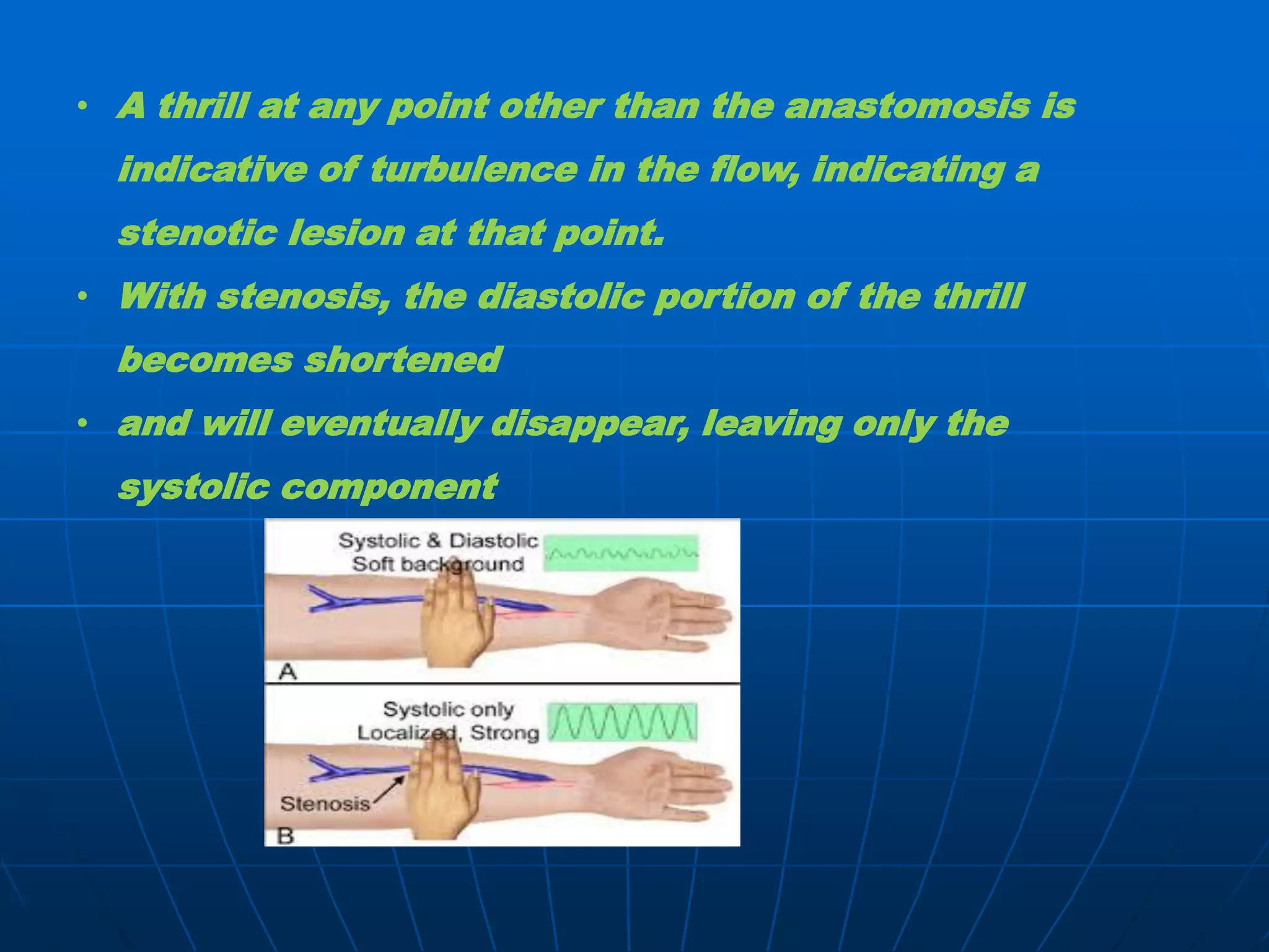 Av fistula examination - copy | PDF