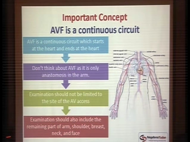 Av fistula examination - dr. tarek fayez | PPT