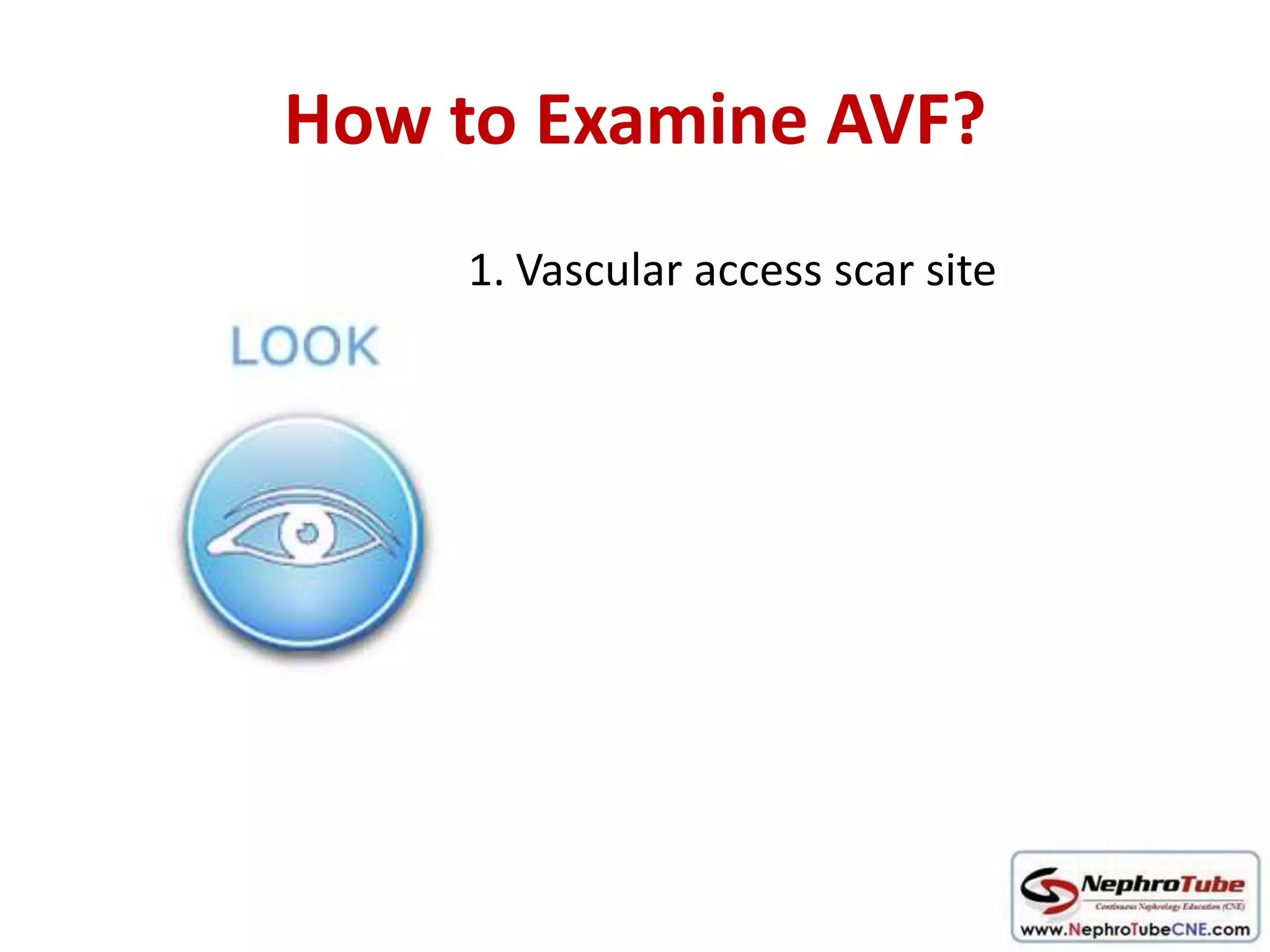 How to examine AVF in 10 minutes - Dr. Gawad | PPTX