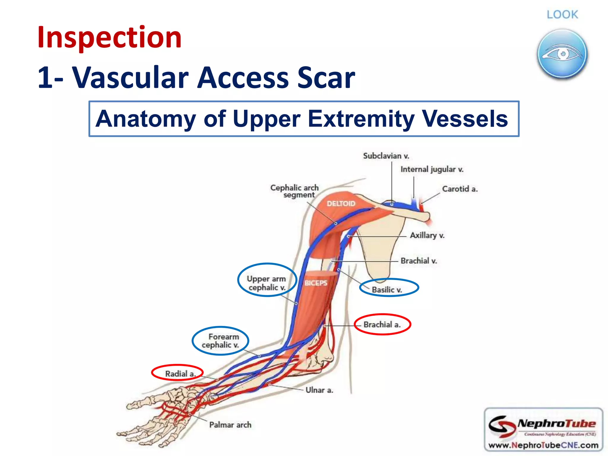 How to examine AVF in 10 minutes - Dr. Gawad | PPTX