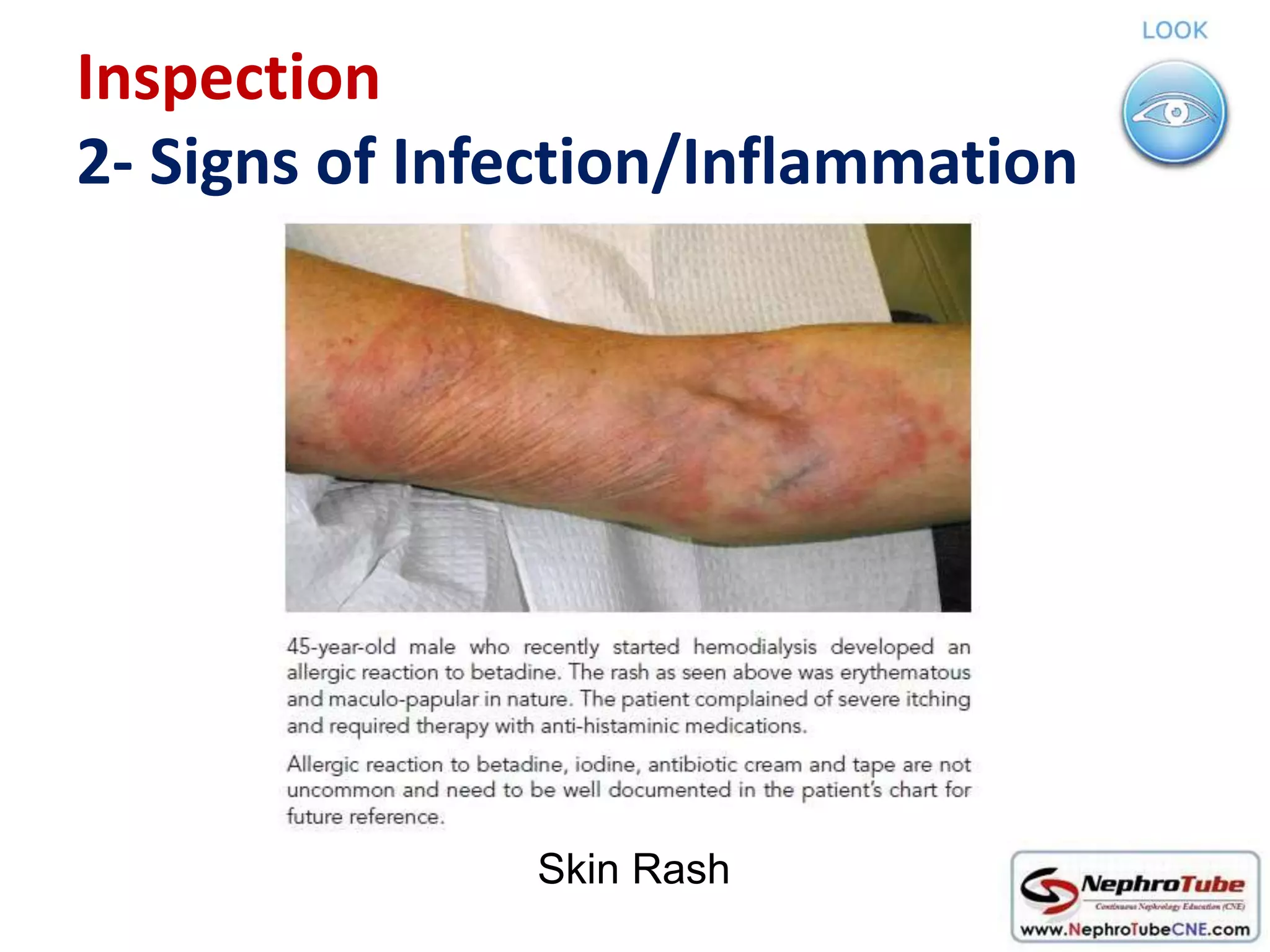 How to examine AVF in 10 minutes - Dr. Gawad | PPTX