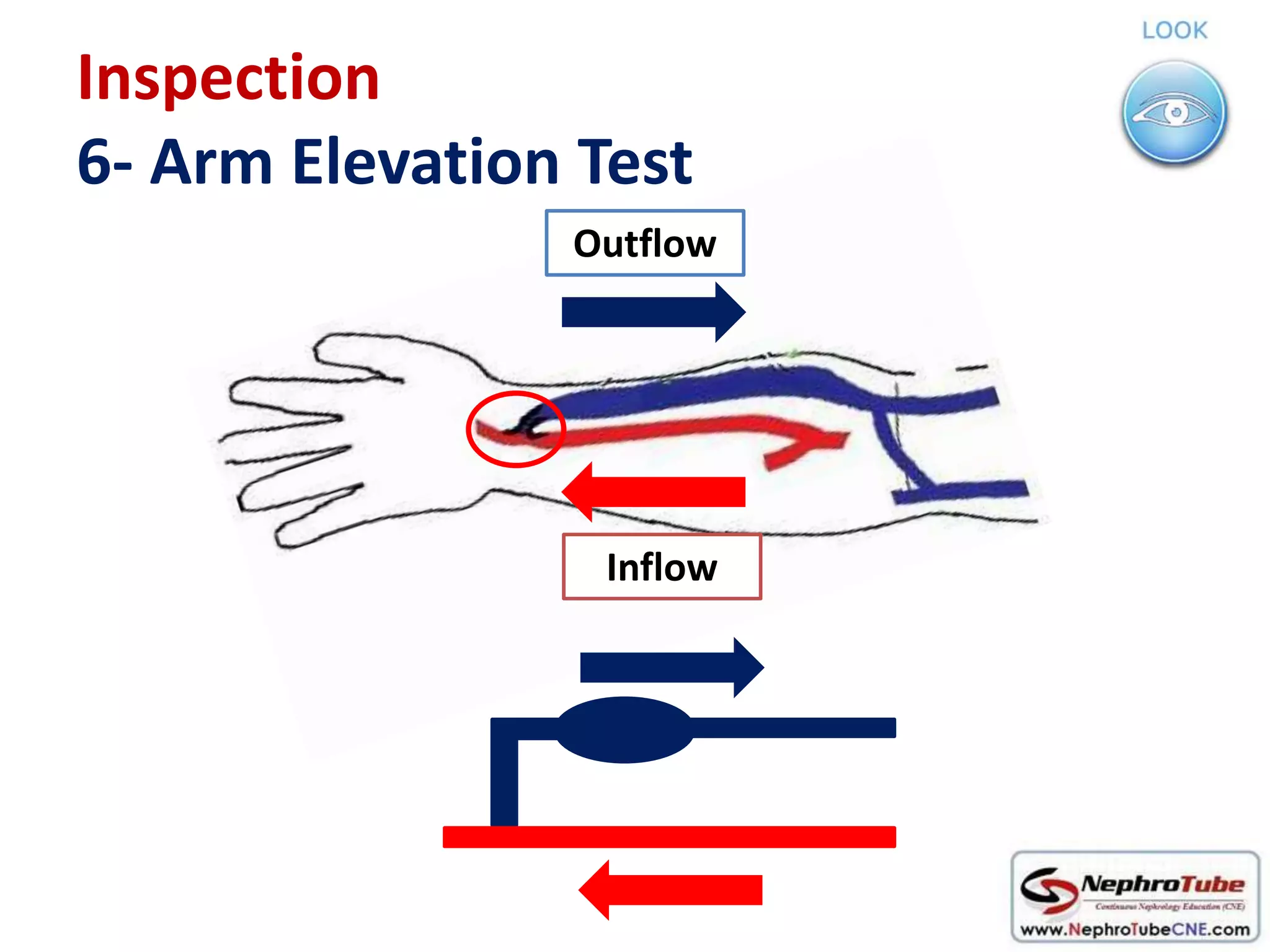 How to examine AVF in 10 minutes - Dr. Gawad | PPTX