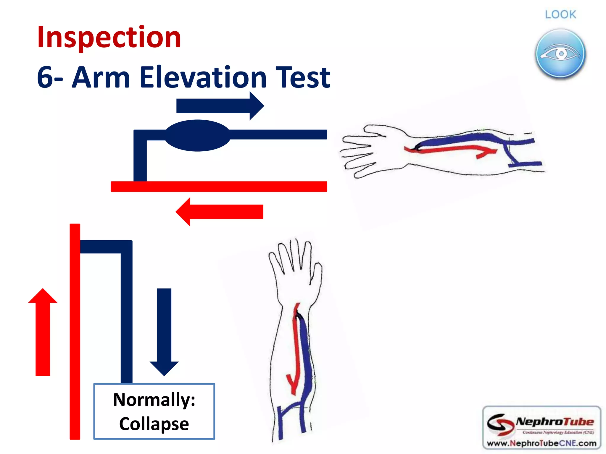 How to examine AVF in 10 minutes - Dr. Gawad | PPTX