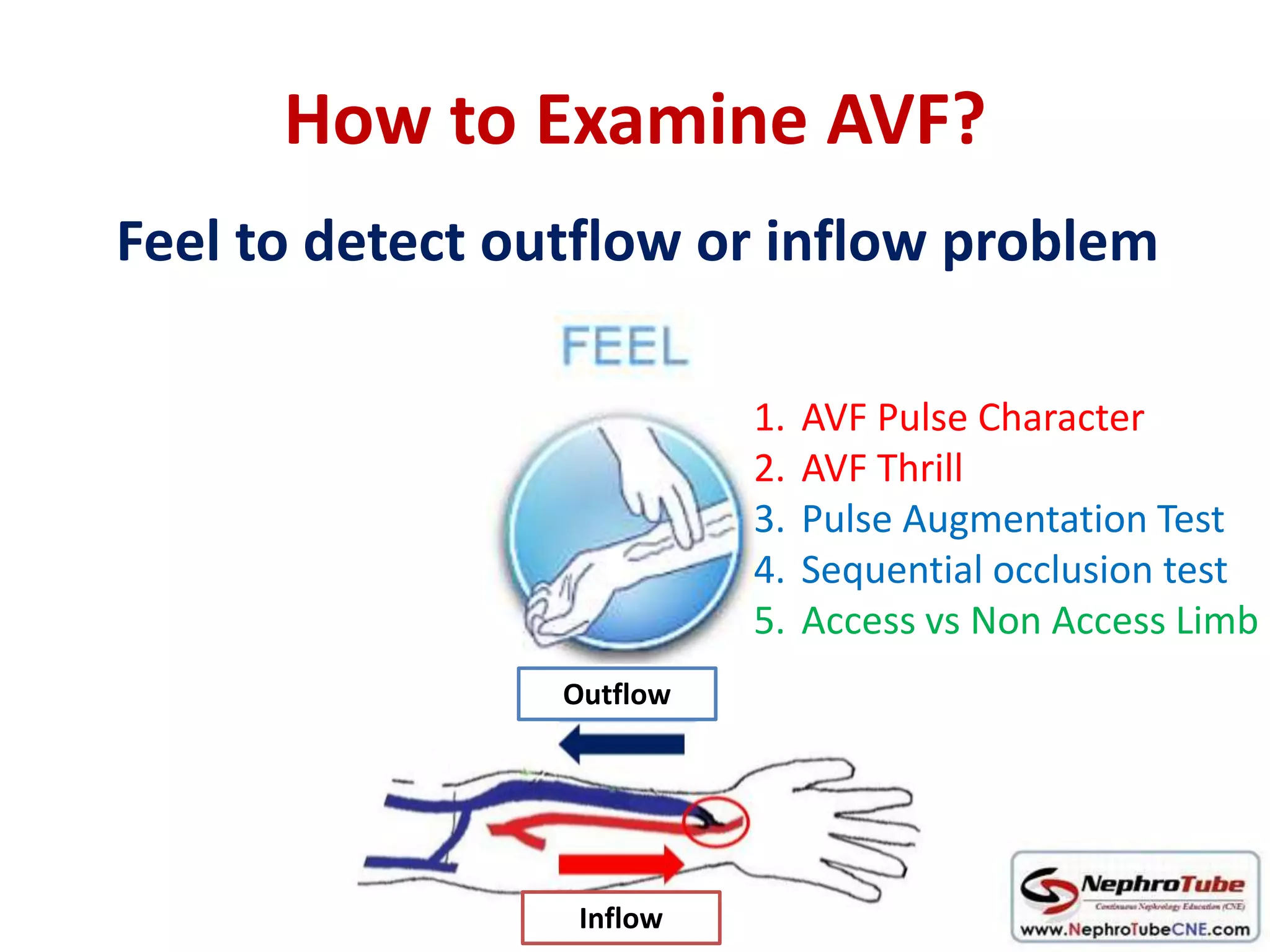 How to examine AVF in 10 minutes - Dr. Gawad | PPTX | Blood Disorders ...