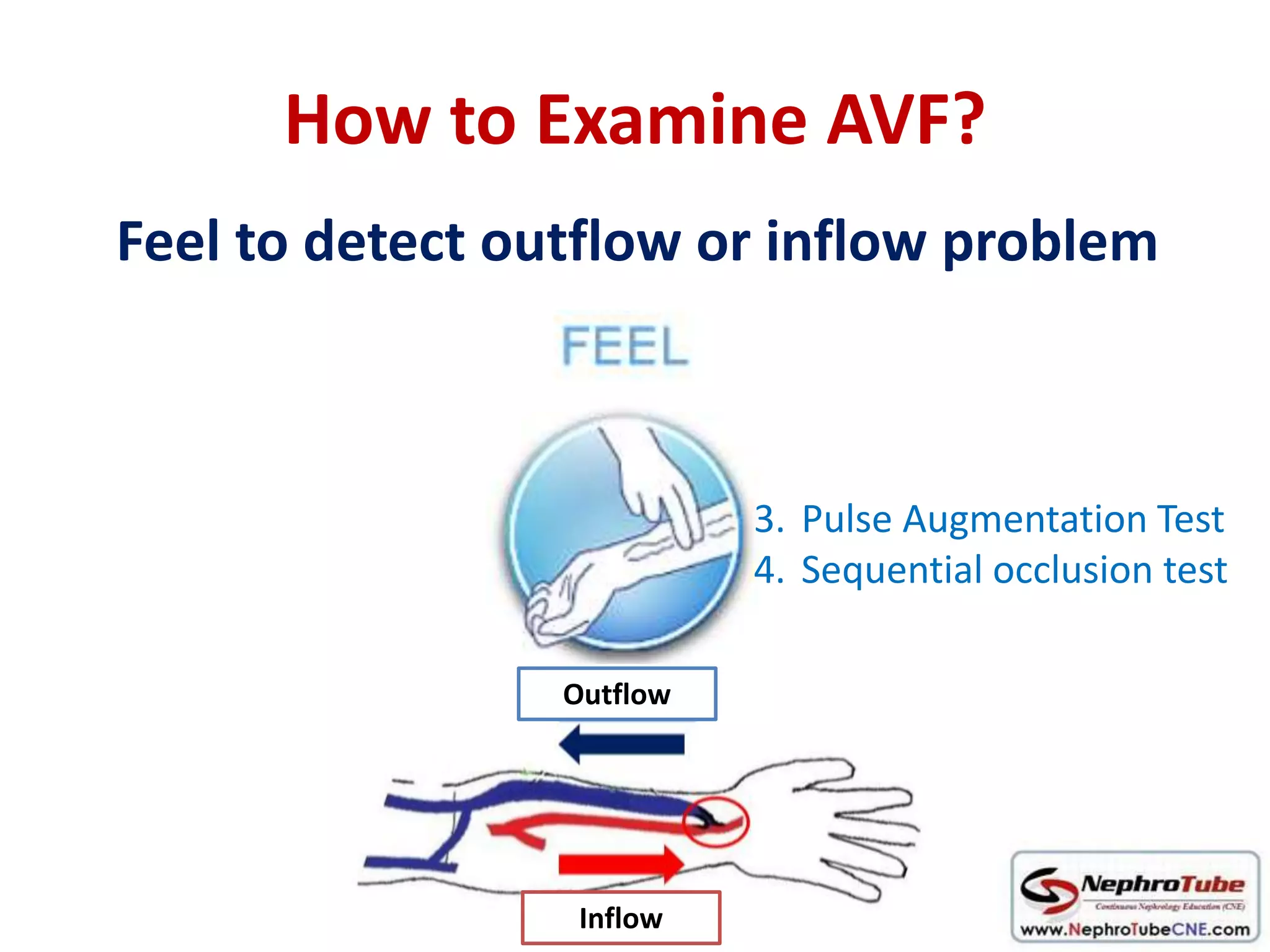 How to examine AVF in 10 minutes - Dr. Gawad | PPTX