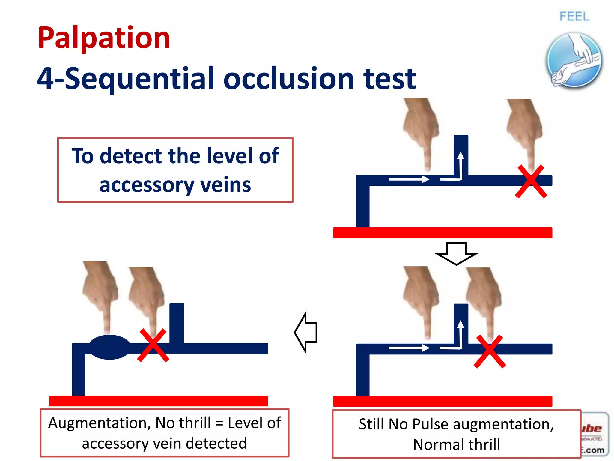 How to examine AVF in 10 minutes - Dr. Gawad | PPTX