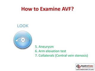 How to examine AVF in 10 minutes - Dr. Gawad | PPTX