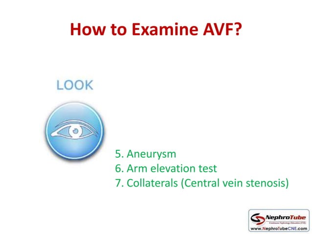 How to examine AVF in 10 minutes - Dr. Gawad | PPTX | Blood Disorders ...