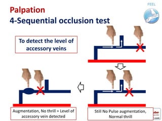 How to examine AVF in 10 minutes - Dr. Gawad | PPTX