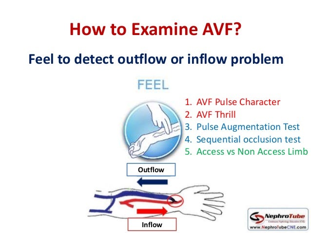 How to examine AVF in 10 minutes