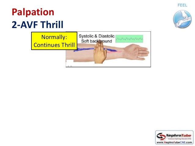 How to examine AVF in 10 minutes