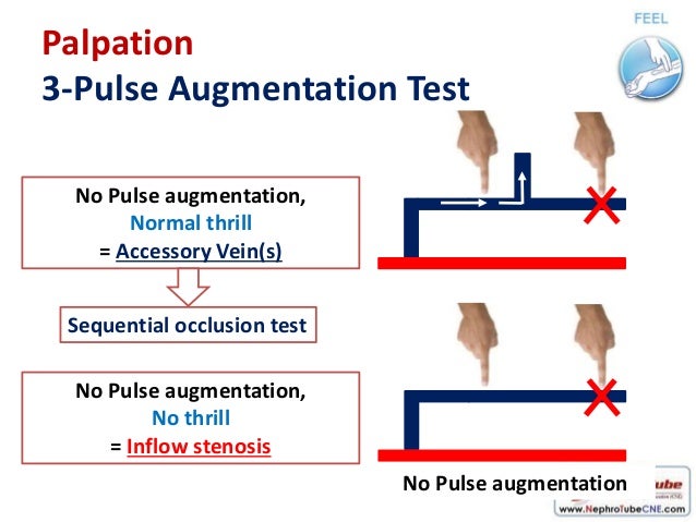 How to examine AVF in 10 minutes