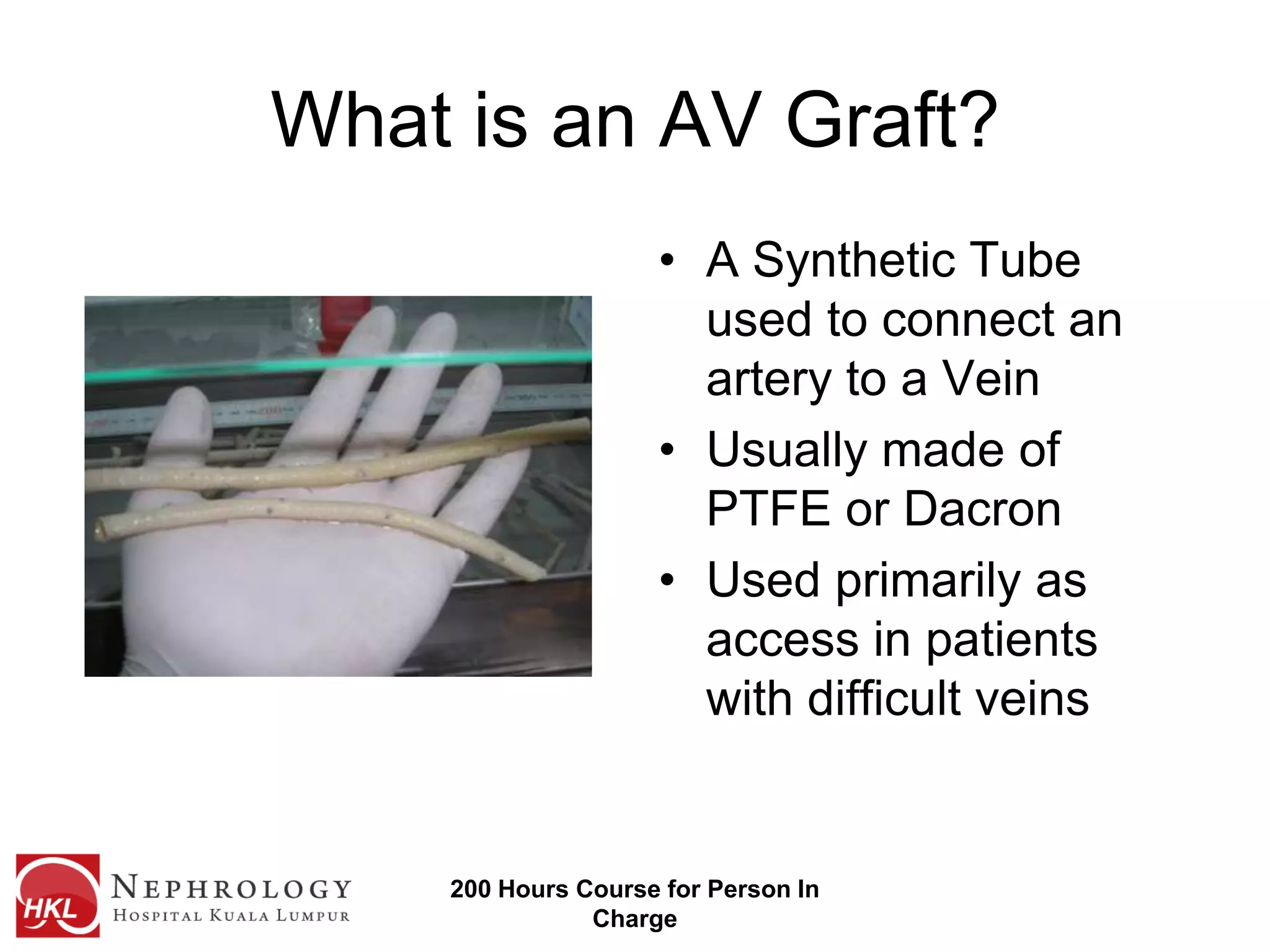 Av grafts and hemodialysis catheters vistana | PPTX