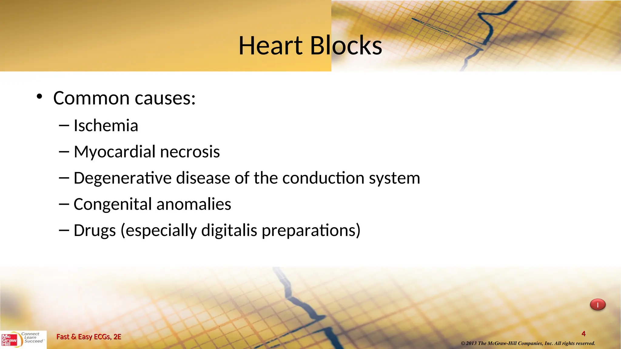 Atrioventricular Heart Blocks causes.ppt