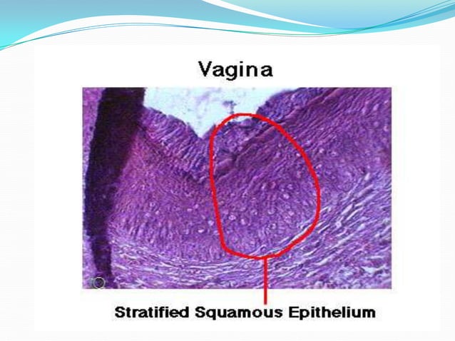 Histology of Avian female reproductive system