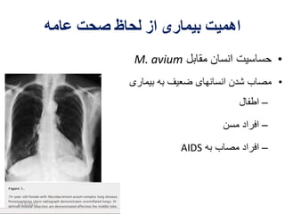 Avian tuberculosis | PDF