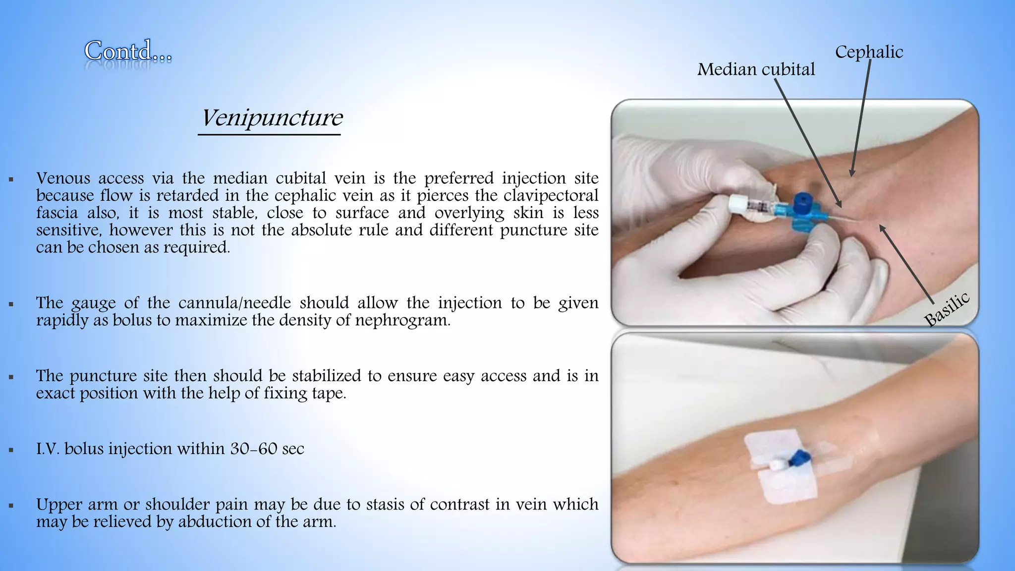 Intravenous urography (IVU)- Avinesh Shrestha | PPTX