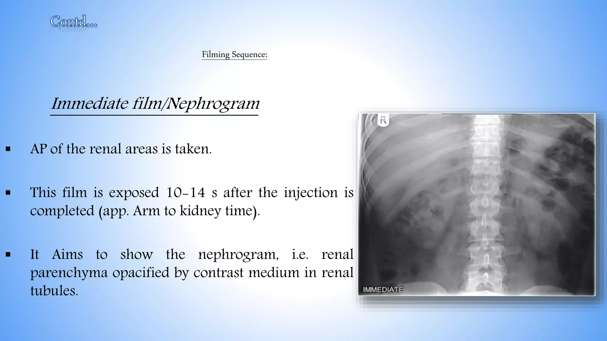 Intravenous urography (IVU)- Avinesh Shrestha | PPTX