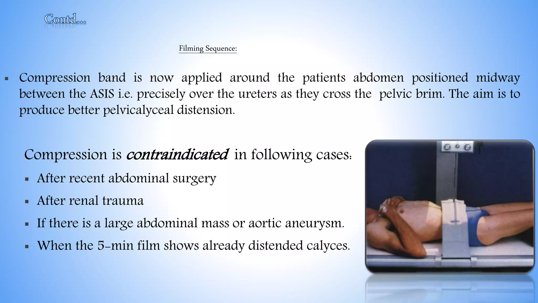 Intravenous urography (IVU)- Avinesh Shrestha | PPTX