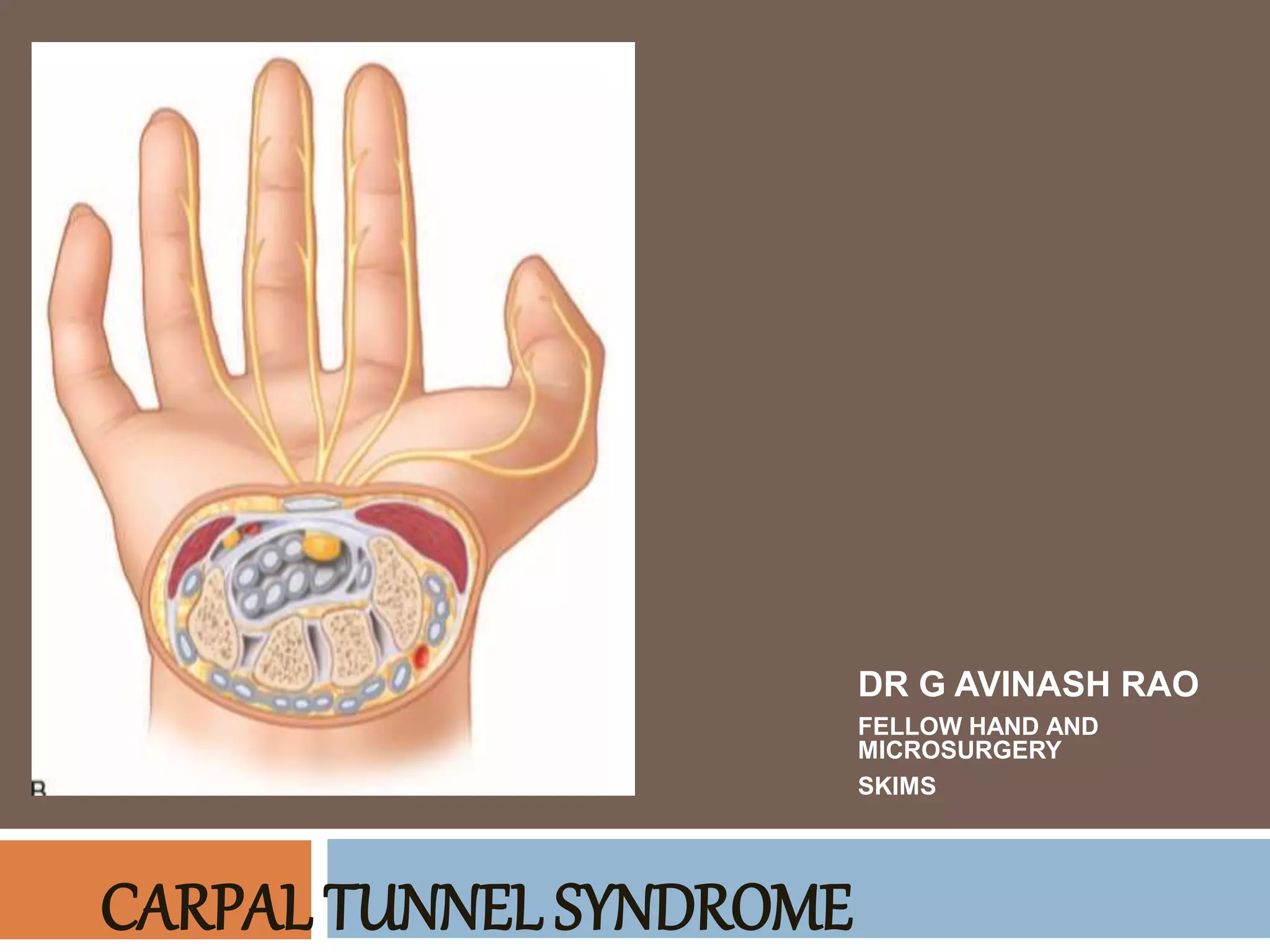 Carpal Tunnel Syndrome- Dr G .Avinash Rao | PPT