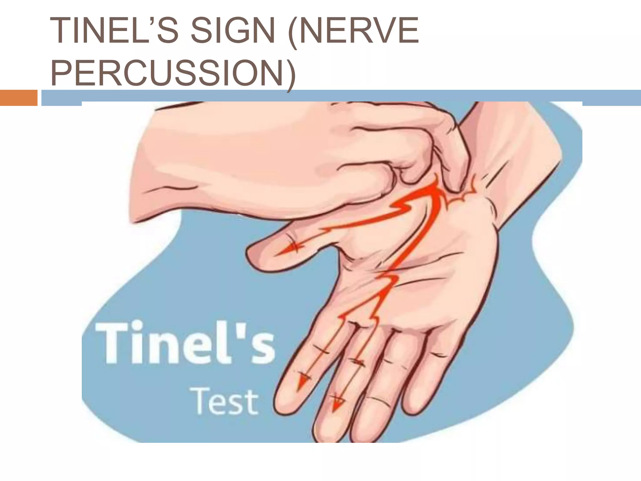 Carpal Tunnel Syndrome- Dr G .Avinash Rao | PPT