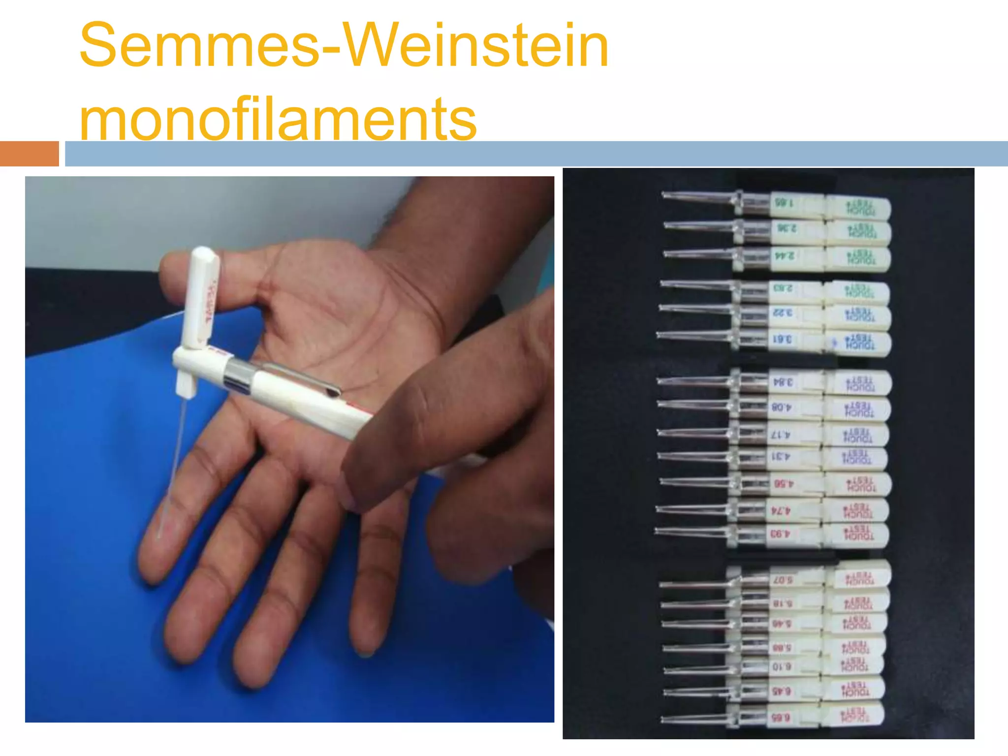 carpal tunnel syndrome - hand surgery | PPT