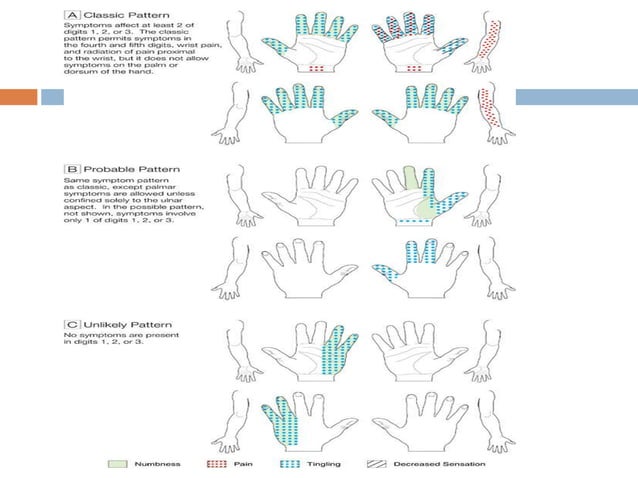 carpal tunnel syndrome - hand surgery | PPT