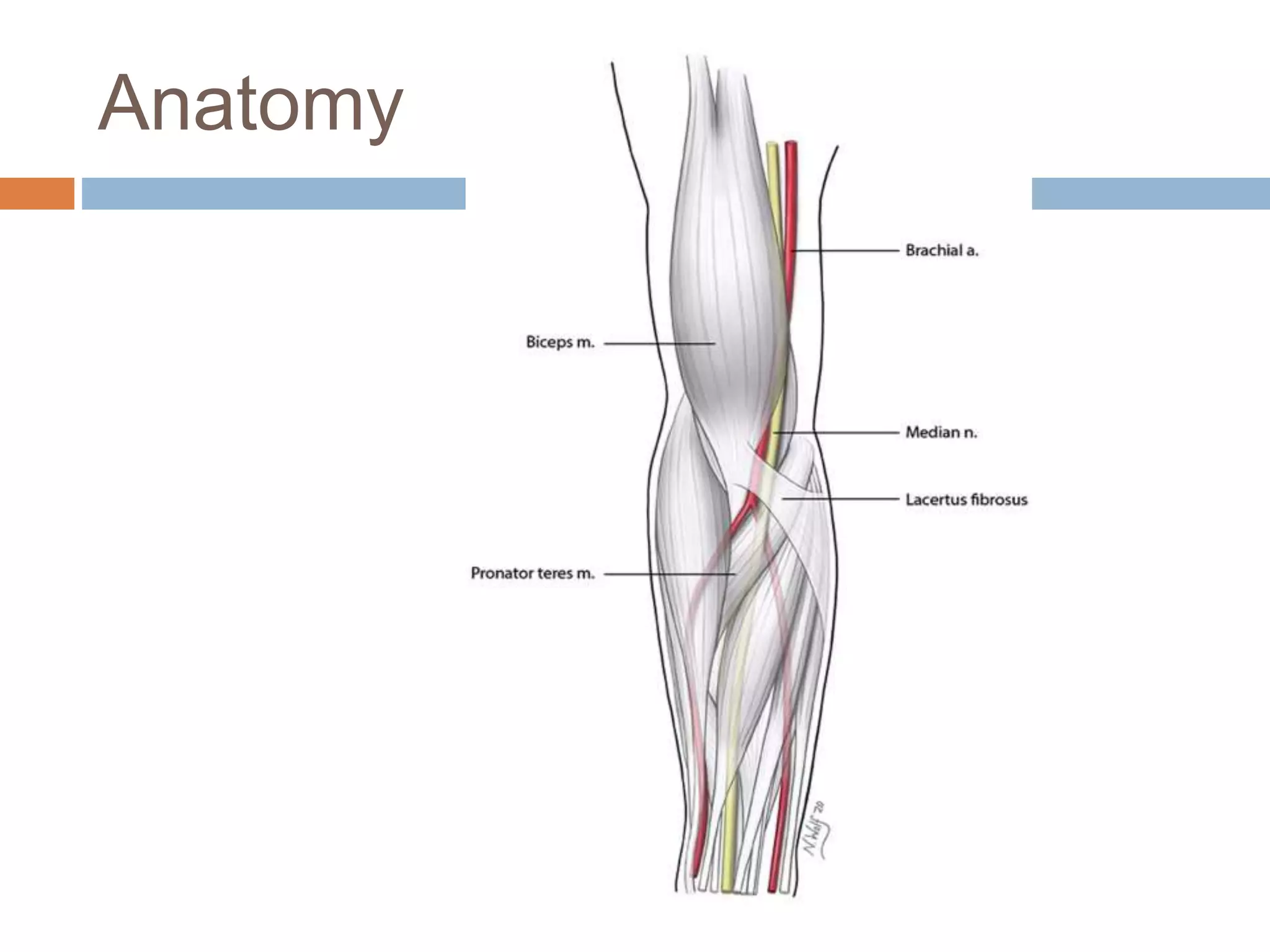 pronator syndrome | PPT