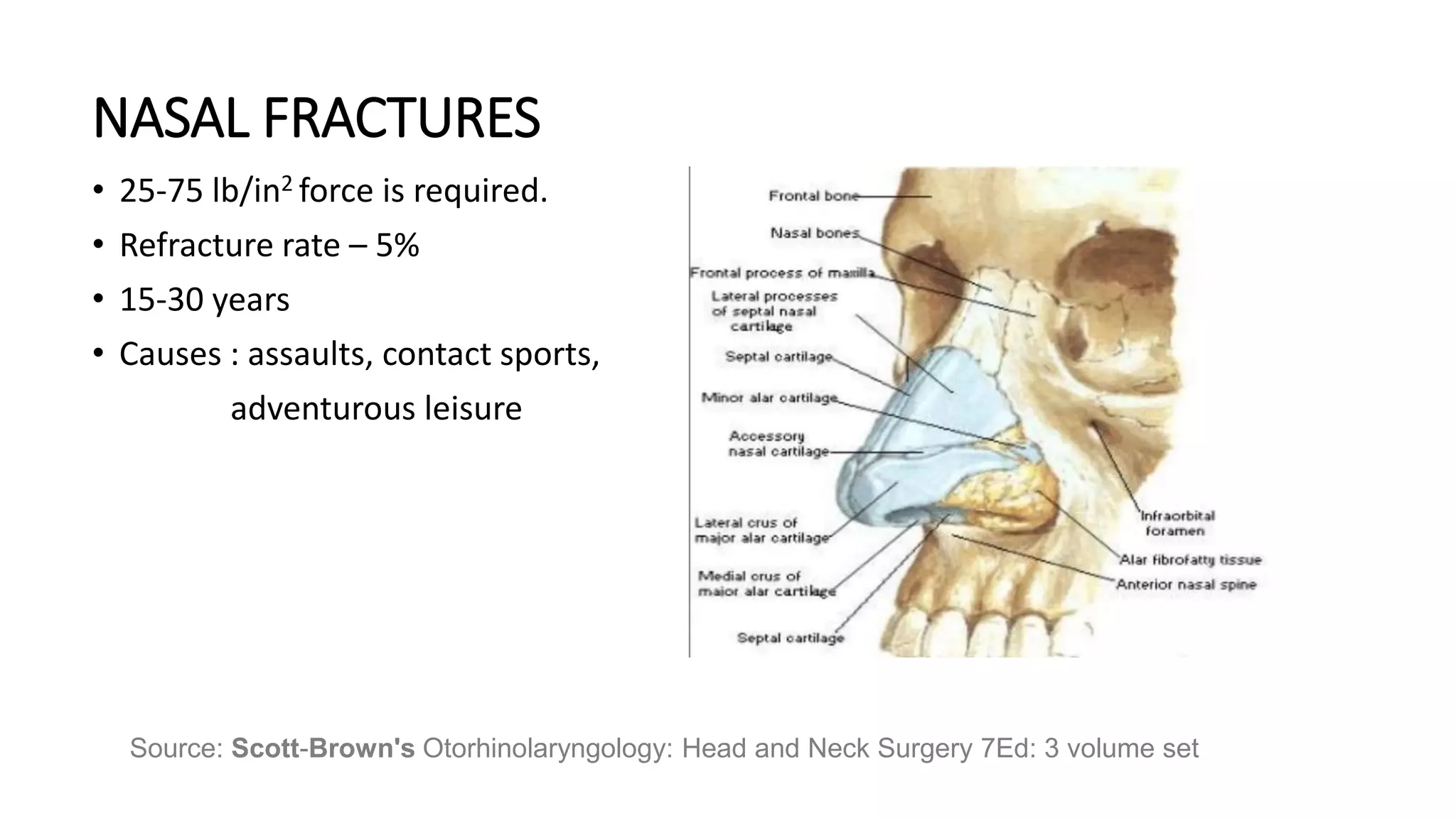 Facial Fractures | PPTX