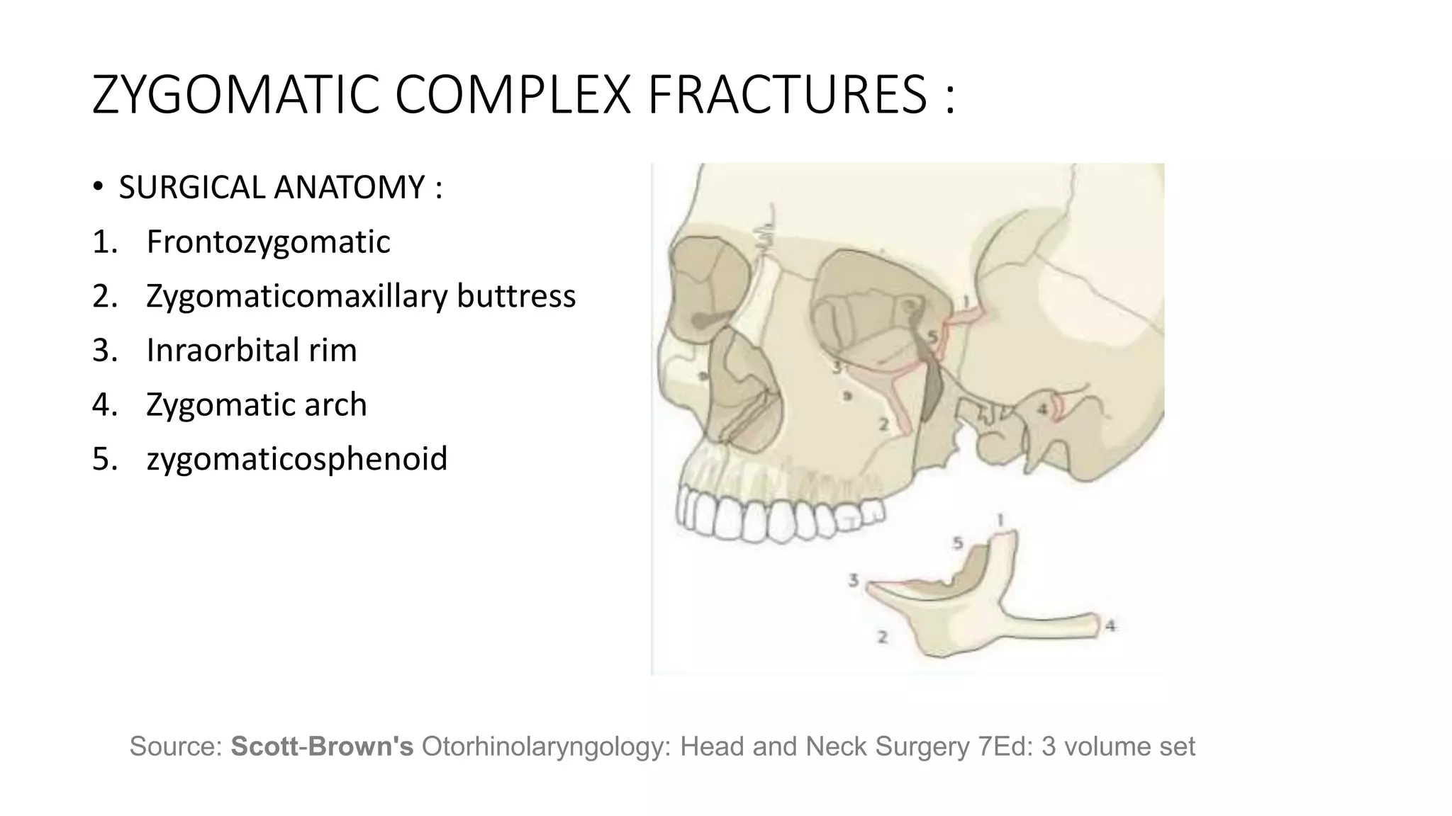 Facial Fractures | PPTX