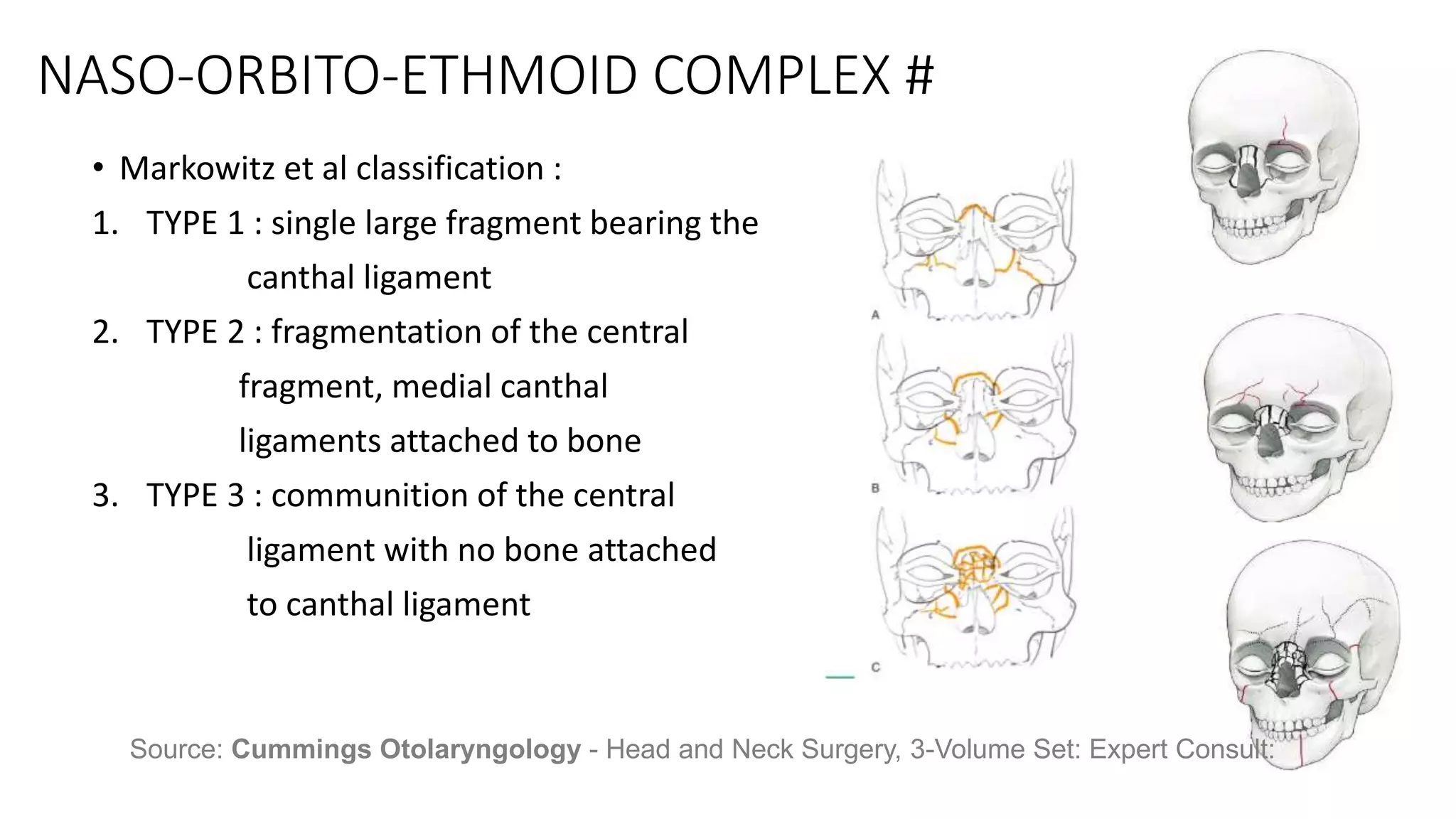 Facial Fractures | PPTX