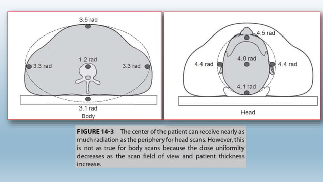CT radiation dose concepts and radiation dose optimization- Avinesh ...