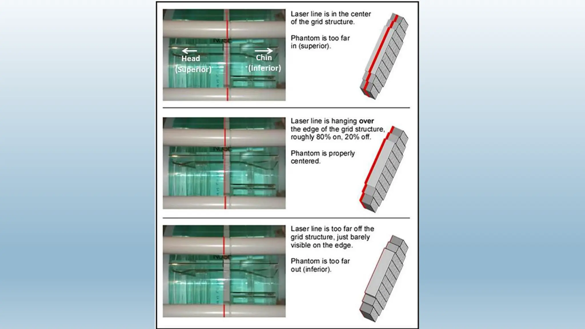 Quality Control in MRI- Avinesh Shrestha | PDF