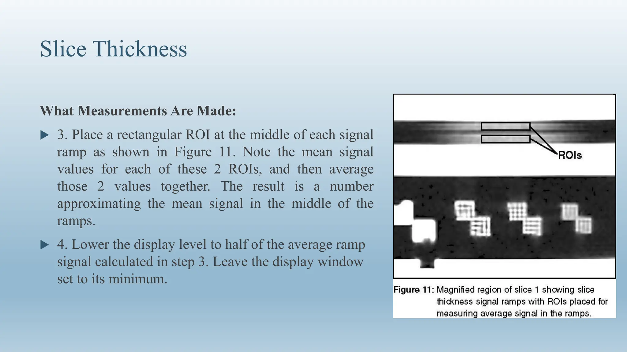 Quality Control in MRI- Avinesh Shrestha | PDF