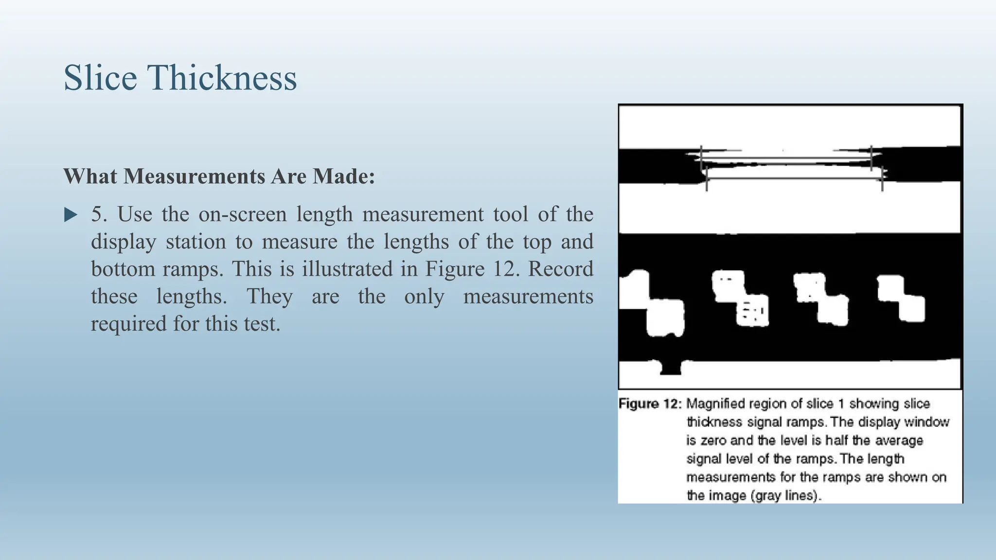 Quality Control in MRI- Avinesh Shrestha | PDF